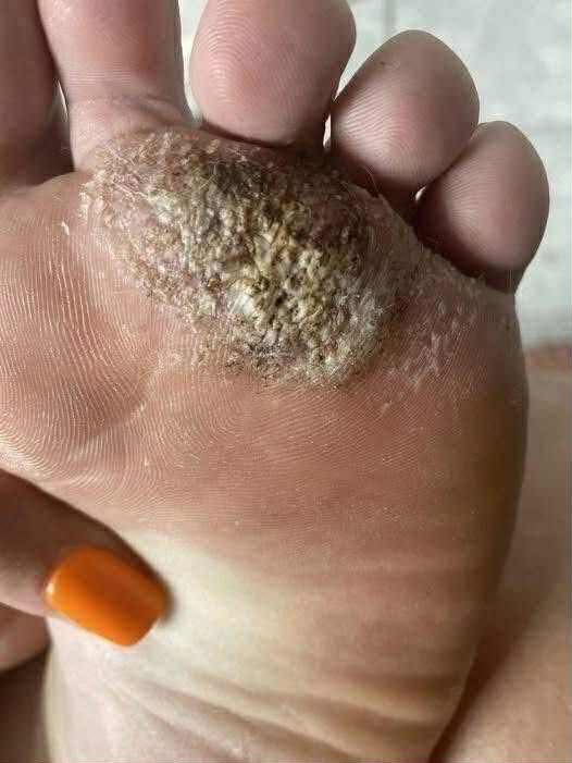 BE VERY CAREFUL . If you get this, you are infected with …. See more ...